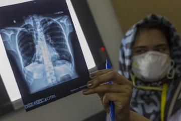 About the endTB project | endTB